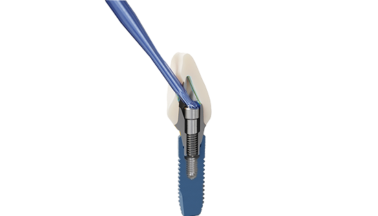 Home | production.zimvie.eu